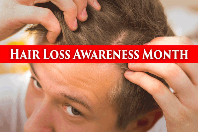 Hair Loss Awareness Month | Dr. Robert Jones